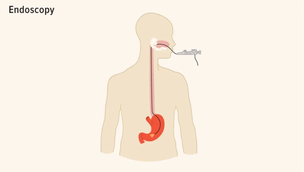 A Comprehensive Guide to Endoscopy - Dr AvinashTank, is a super ...