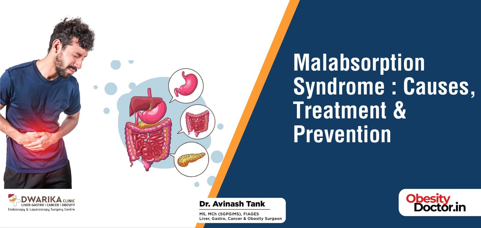 Malabsorption Syndrome: Causes, Treatment & Prevention - Dr AvinashTank ...
