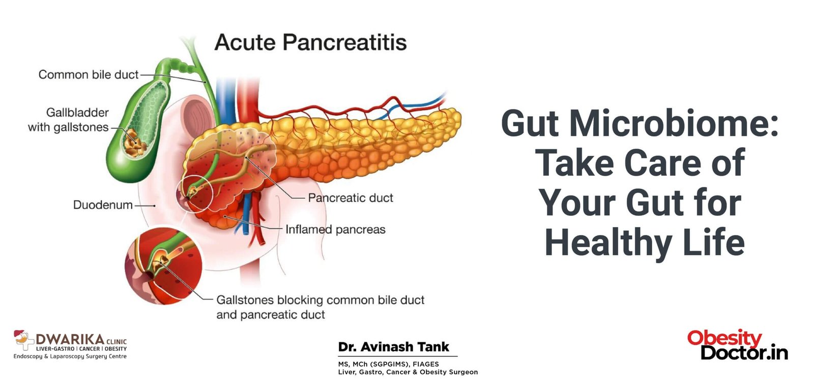 Gut Microbiome: Take Care of Your Gut for Healthy Life - Dr AvinashTank ...