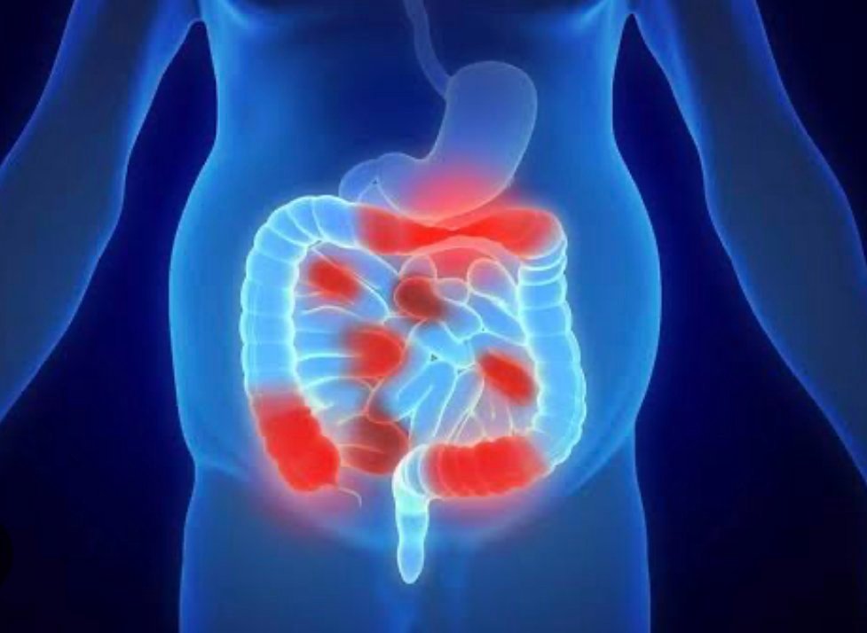 Protect the mucus layer of intestine to avoid trigger for Inflammatory ...