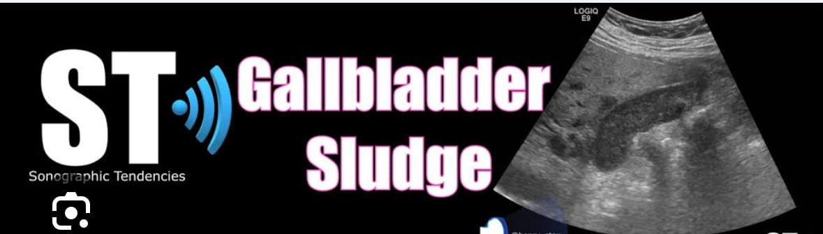 Gallbladder Sludge vs. Gallstones: Understanding the Difference - Dr ...